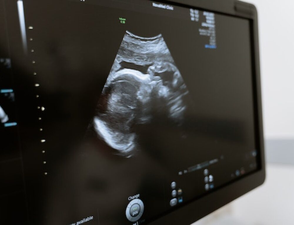 CT vs. MRI: Understanding the Differences and Making the Right Choice